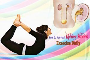 Top 12 Tips How To Prevent Kidney Stones From Forming Naturally