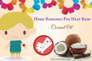 30 Best Natural Home Remedies For Heat Rash On Face & Body