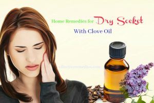 9 Best Natural Home Remedies For Dry Socket Pain & Other Symptoms